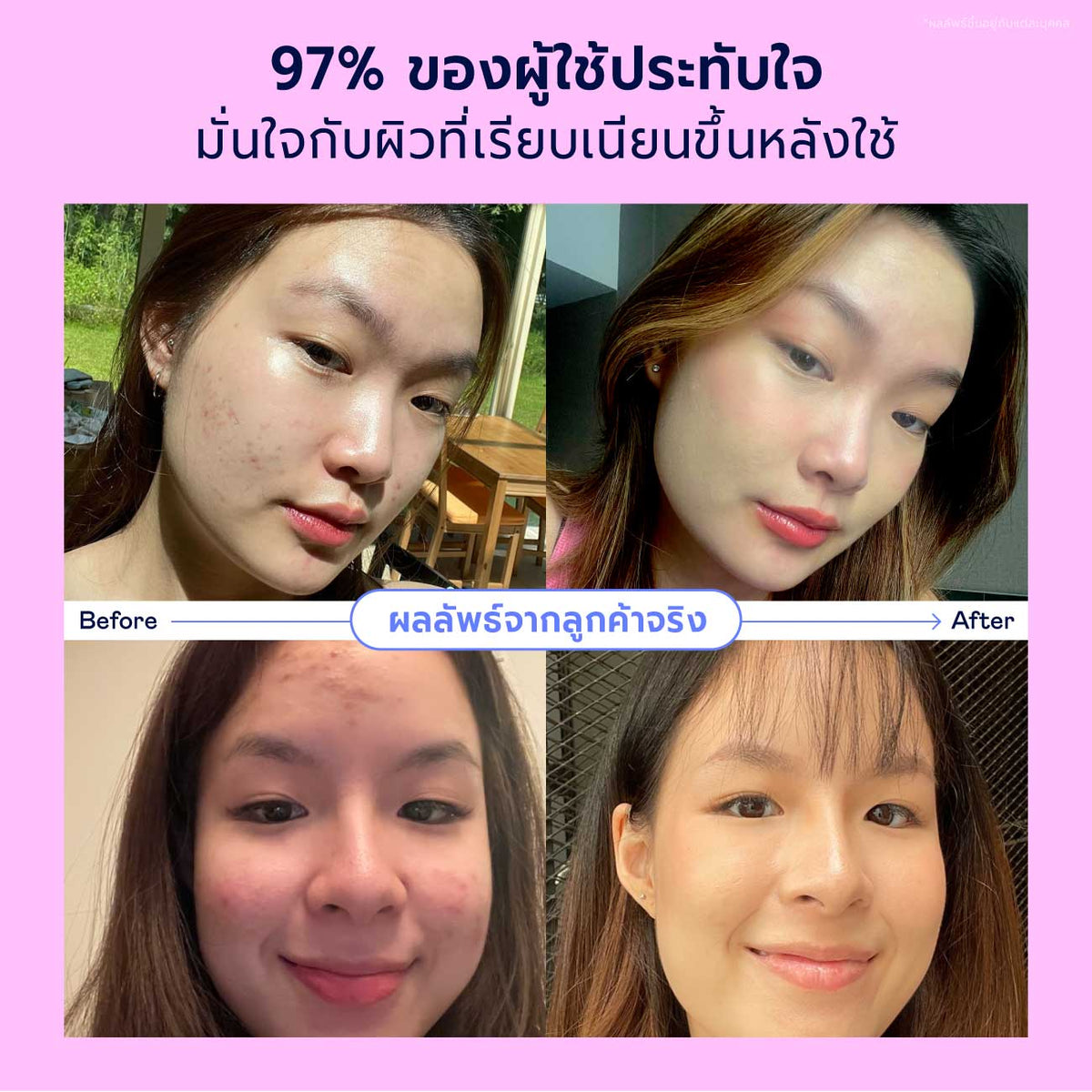 Repair and Restore Bundle – Divyne