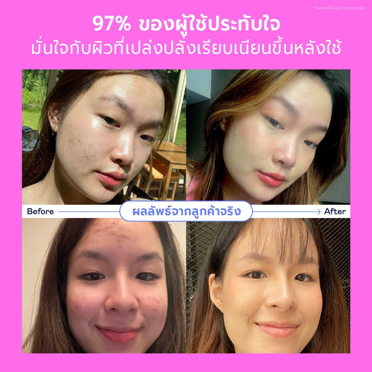 Skincare Birthday Bundle – Divyne